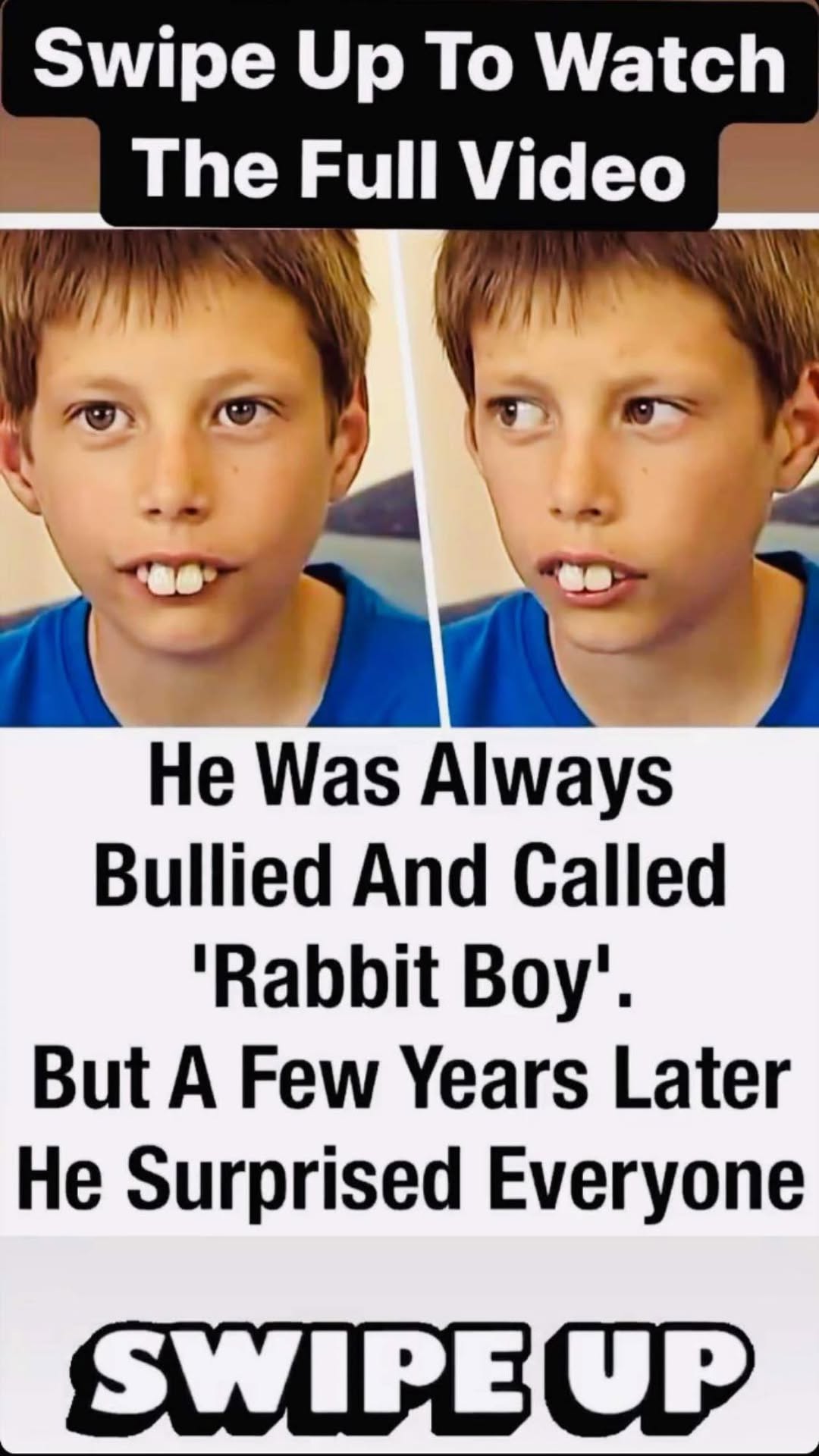 Boy Called “rabbit” And Bullied For His Teeth Gets Incredible ...